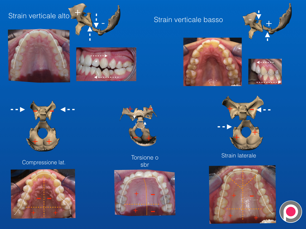 Morfologia adattativa del palato. – OP Analysis