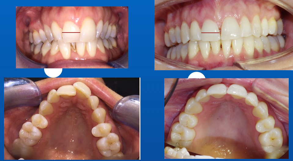 Morfologia adattativa del palato. – OP Analysis